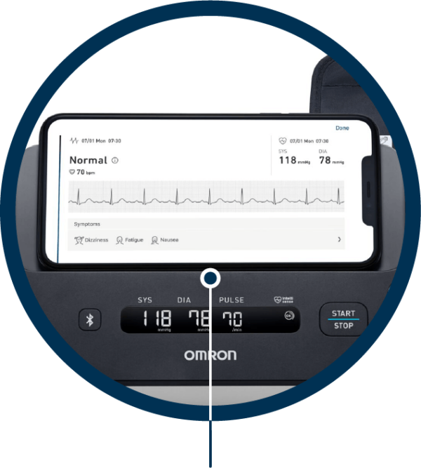 ECG Monitoring | Omron Healthcare
