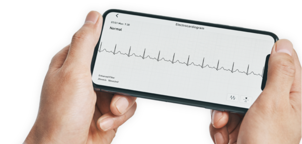 ECG Monitoring | Omron Healthcare