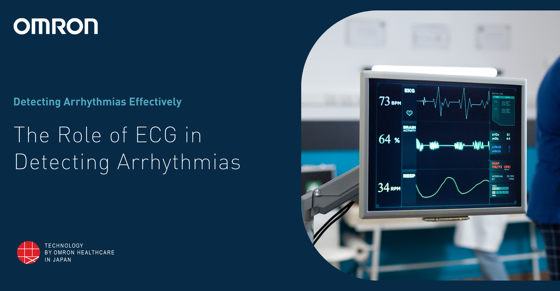 The Role of ECG in Detecting Arrhythmias | Omron Healthcare