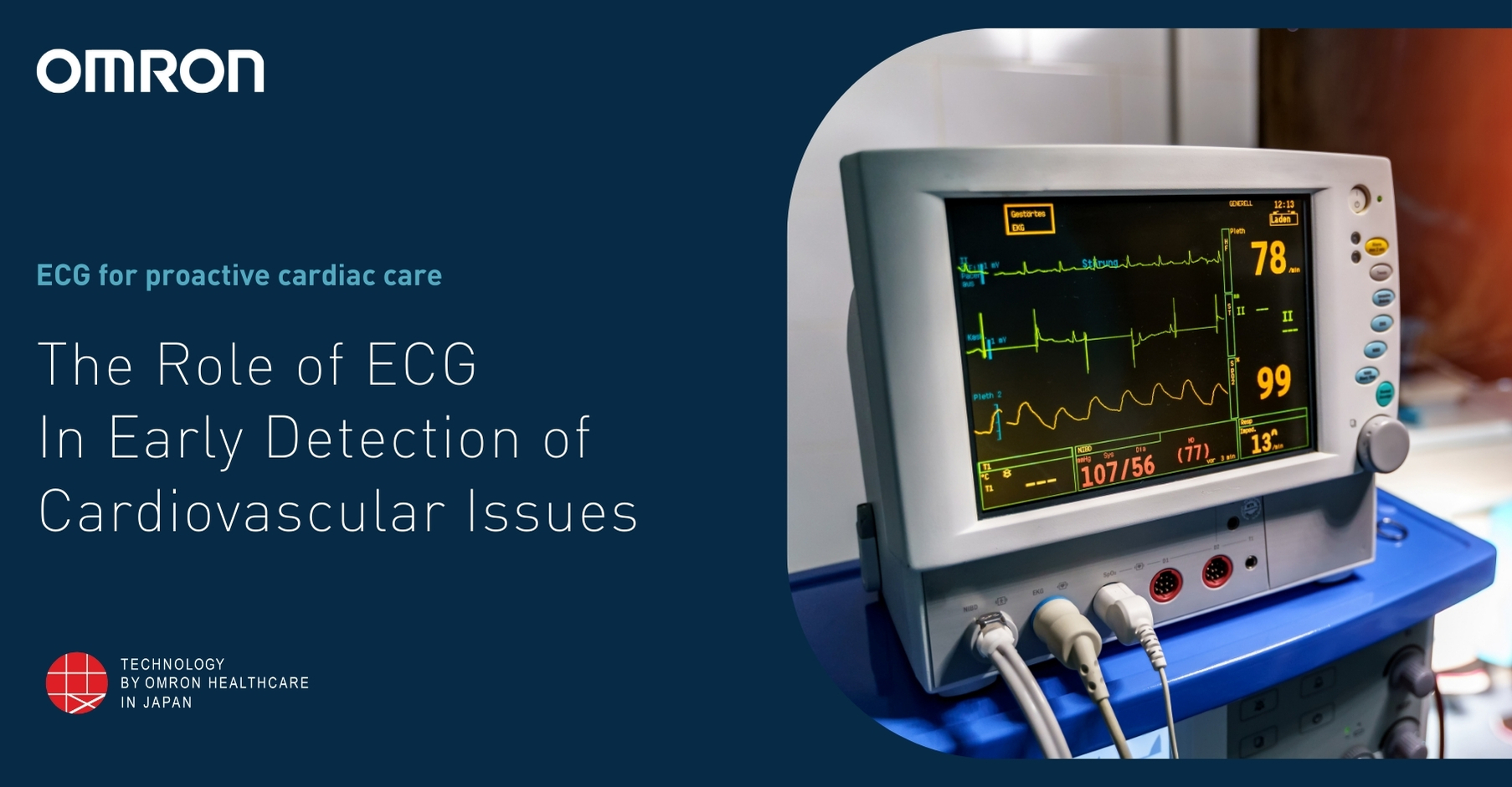 The Role of ECG in Early Detection of Cardiovascular Issues | Omron ...